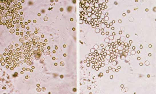 [Haematology] Microscopic Examination of Urinary Sediment - Cells ...