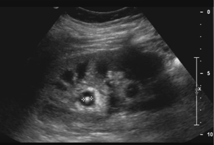 Flanco Esquerdo : 2016