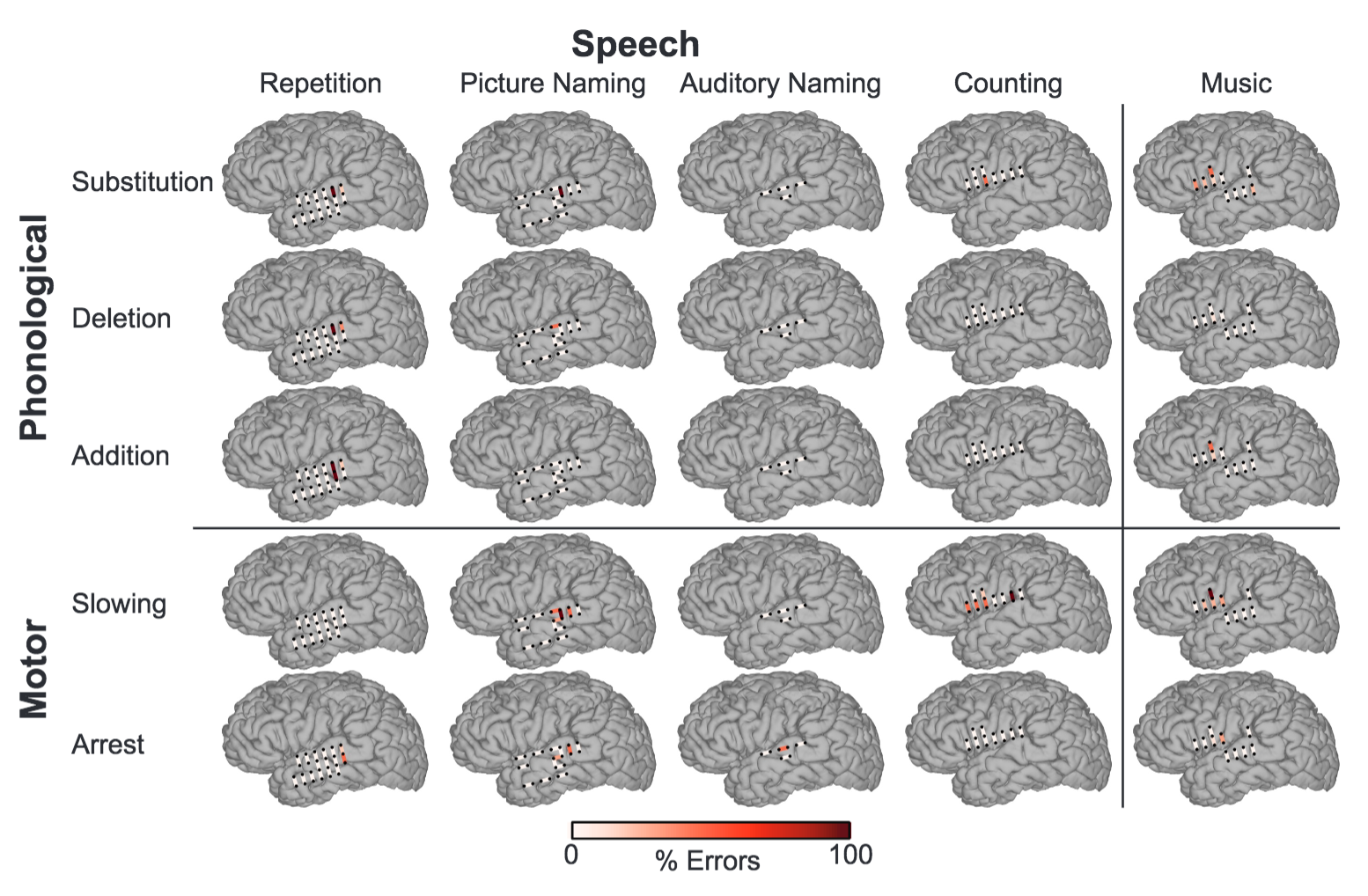 Music Cognition on Left Temporal and Parietal Lobe: Last week in San ...