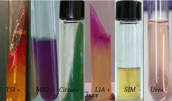 Miyo Spiral: Práctica 8 Coprocultivo