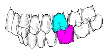 Caso Clínico Nº3: 5° Sesión