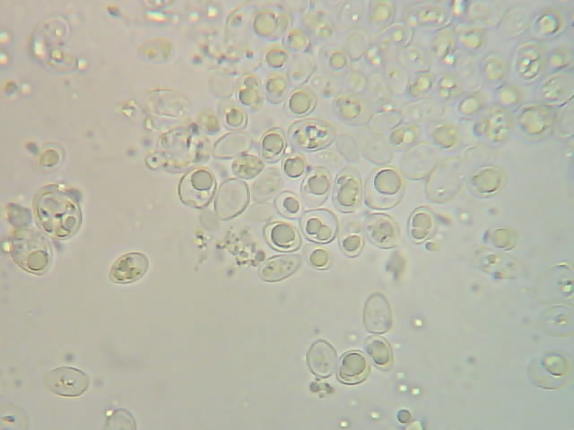 Saccharomyces Under Microscope