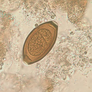 Analis Kesehatan: PEMERIKSAAN TINJA METODE KATO KATZ
