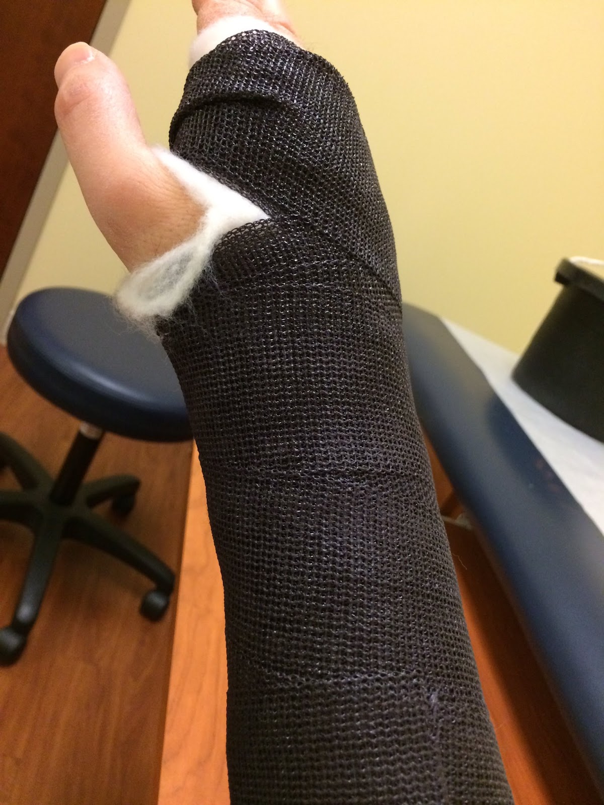 Sean's Ramblings: Wrist and Blog Updates