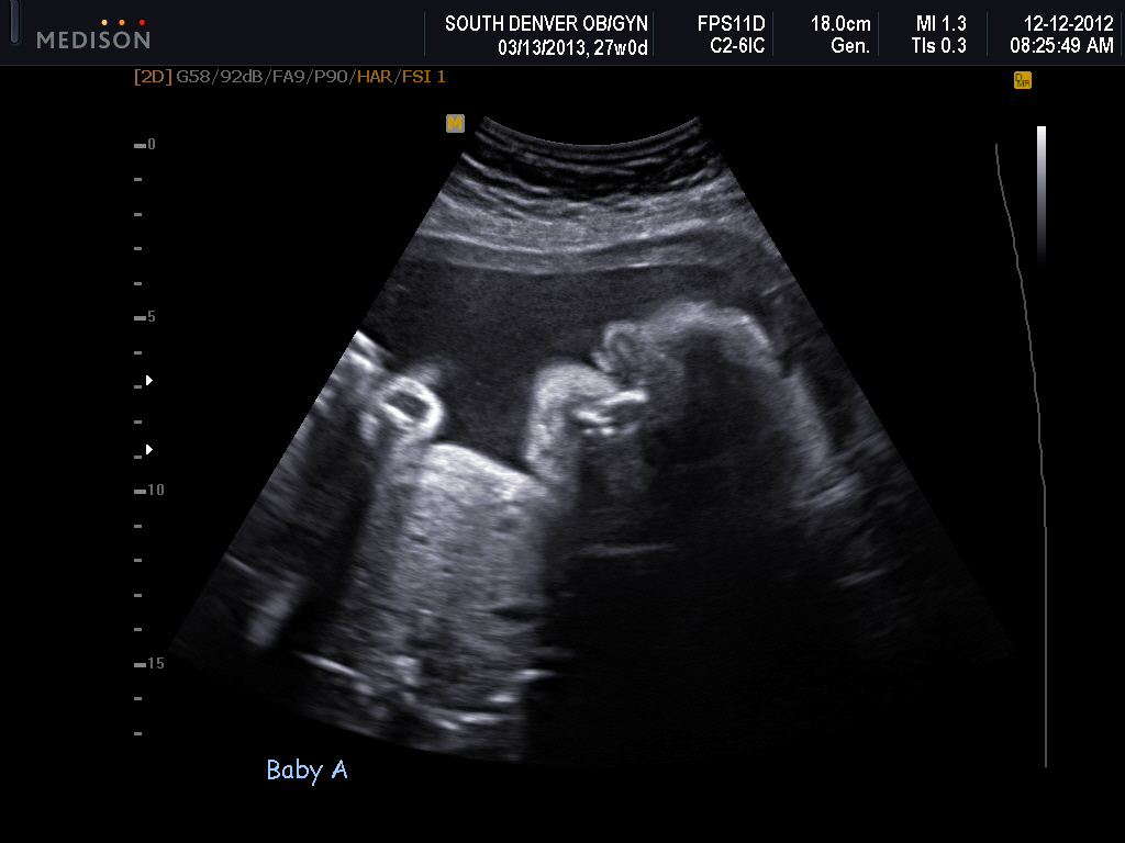 A Road Well Traveled: 27 Weeks! (With Ultrasound and Bump Photos)