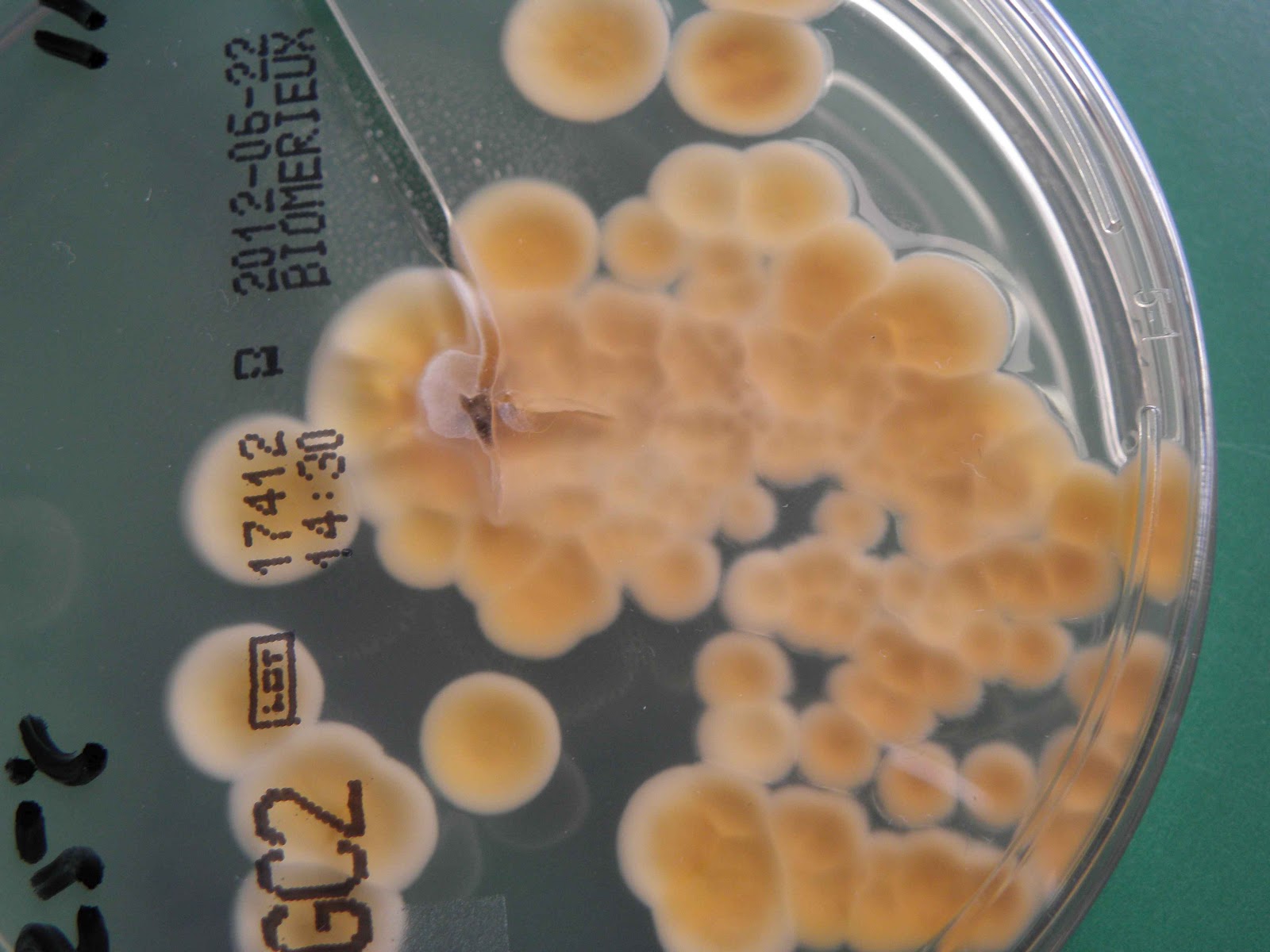 ATLAS MICOLOGIA: ASPERGILLUS VERSICOLOR