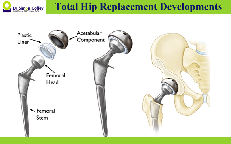 Dr Simon Coffey - An Orthopaedic Surgeon in Sydney,Australia: 2016