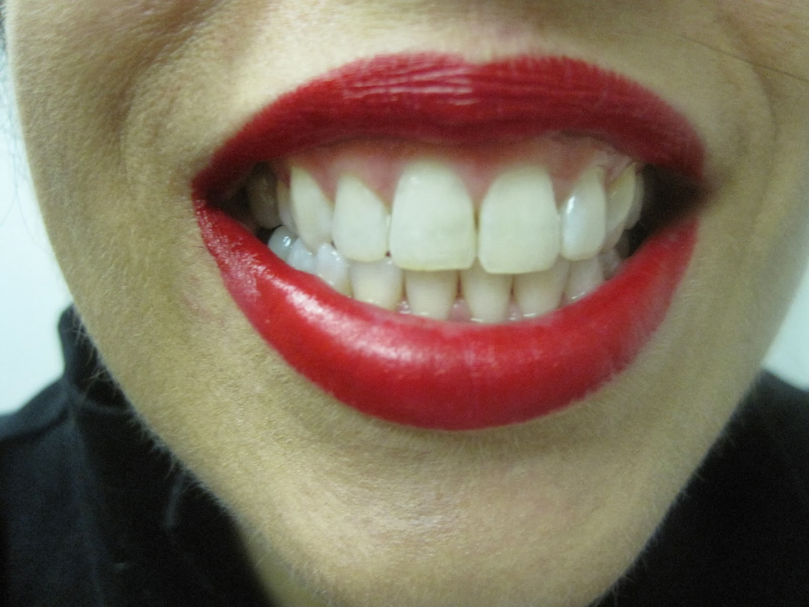 Whom You Know: TOP TEETH: If Going To Your Dentist Is Not Like Going to ...