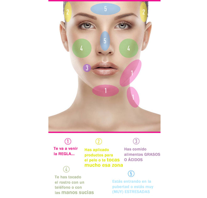 Espinillas, dónde y por qué salen