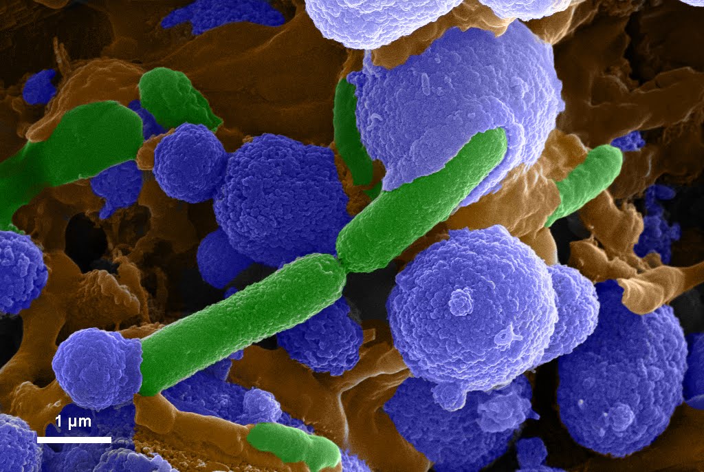 Bacteria that turns to stone