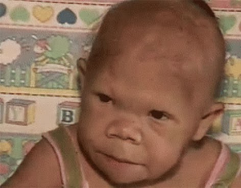 Shape Your Vision: “Syndrome X”– the real X File case