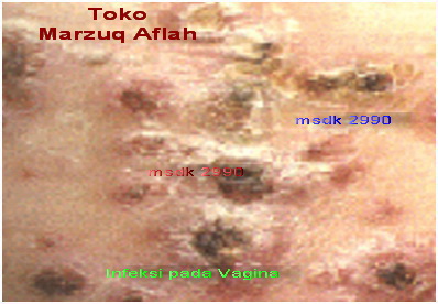 PUYIKANG ~ Toko Marzuq Aflah