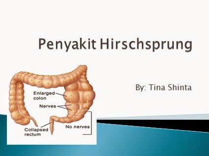 Askep Pada Anak dengan Penyakit Hirschsprung