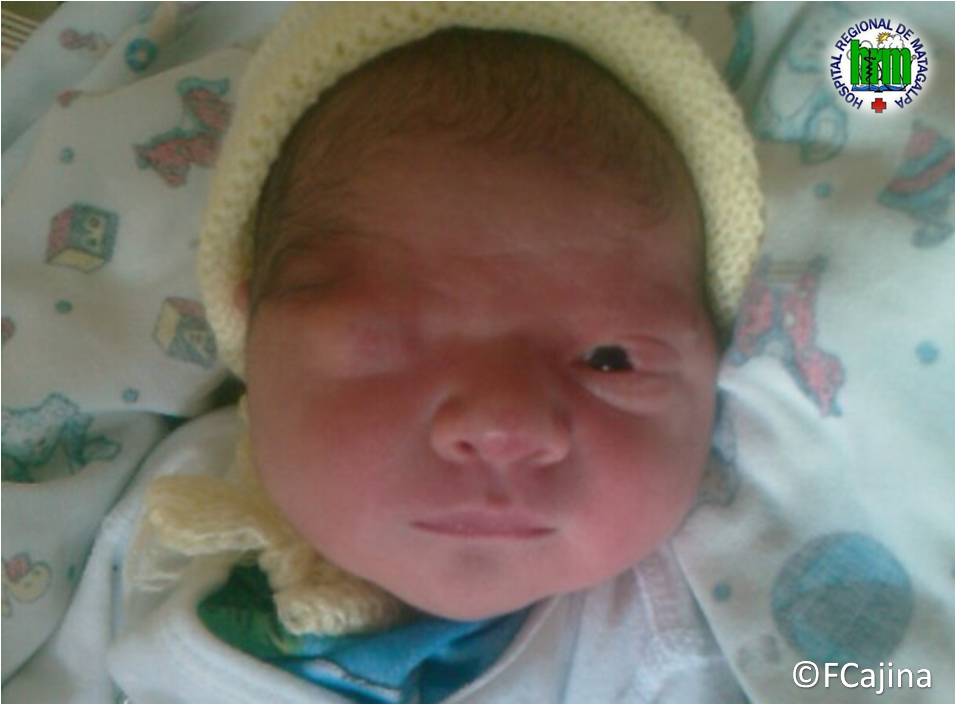 Dr. Frank Cajina Gómez: Atlas de Defectos Congénitos HECAM