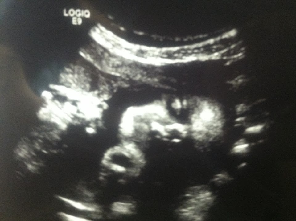 Destiny Brought You To Me: Jaxon Jeremiah Wetzel