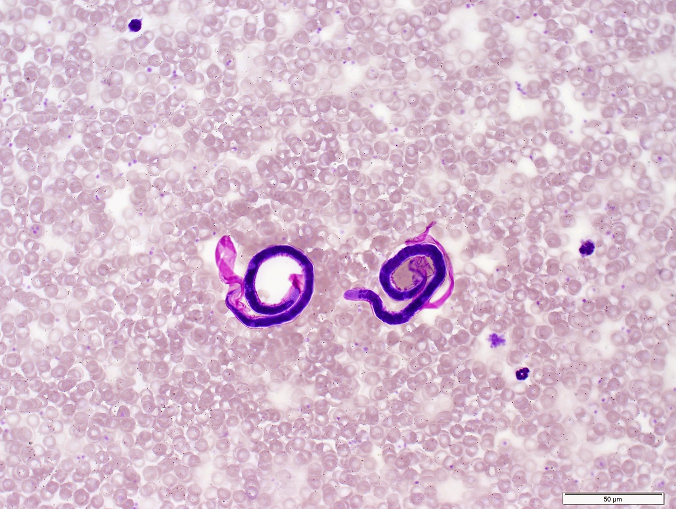 Brugia Malayi Morphology