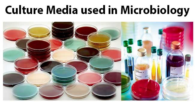 List of culture media used in microbiology