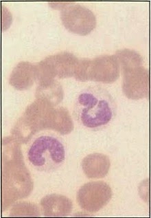 Células importantes en hematología: NEUTRÓFILO EN BANDA (CAYADO)
