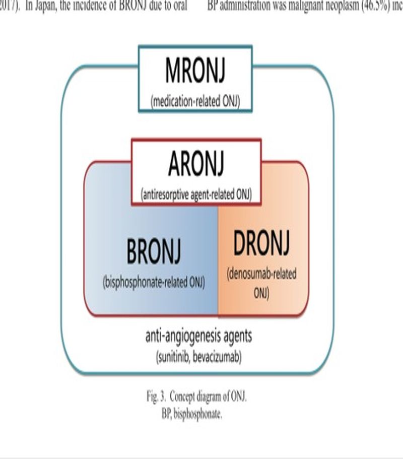 楊全斌: The Problem Of ARONJ(MRONJ)