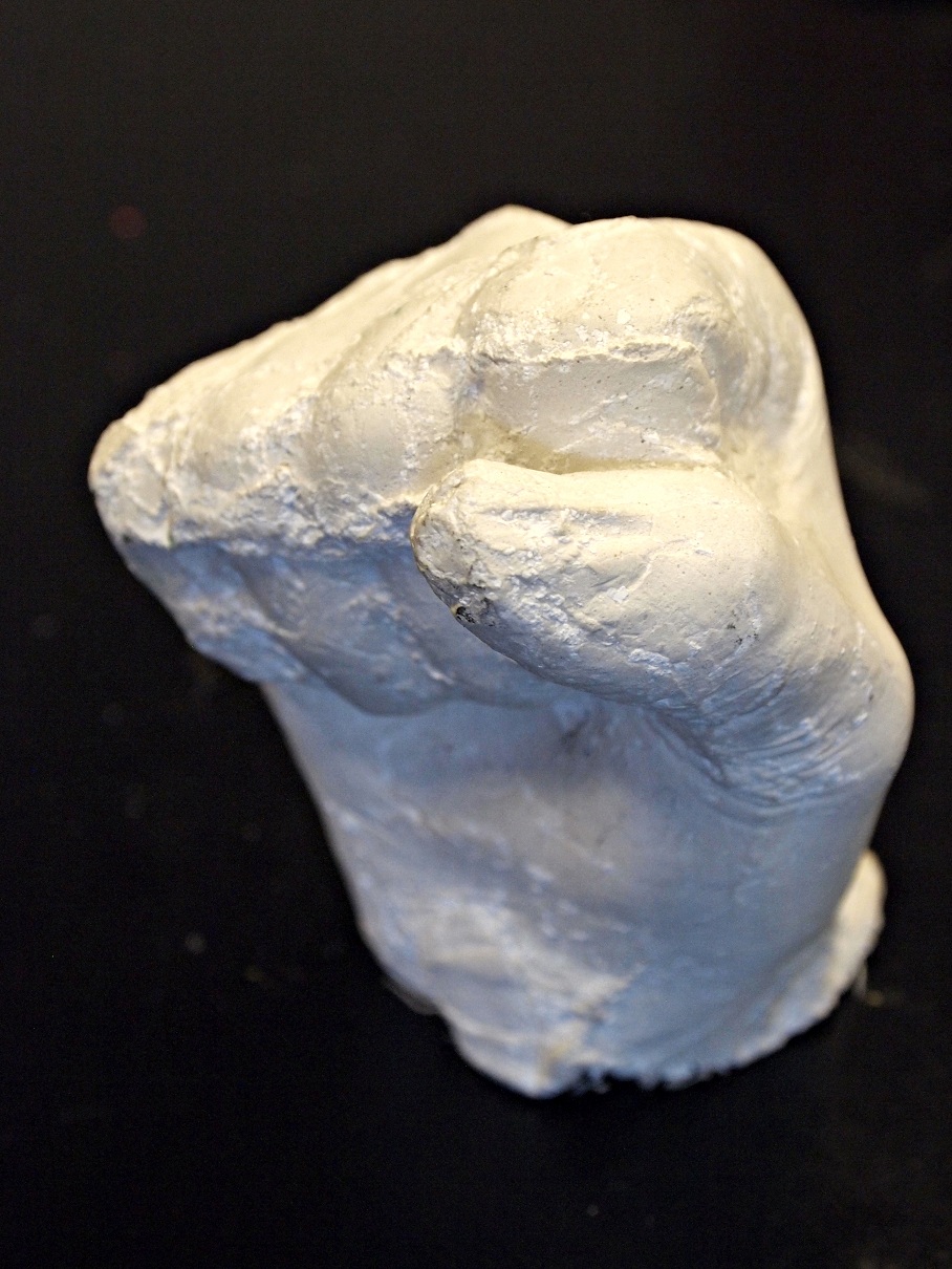 Bildsajt: En ensam gipshand!