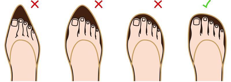 Complete Podiatry Blog: Ingrowing Toe Nails