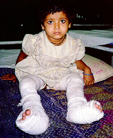 Education to Disorders: Cause of Locomotor Disability