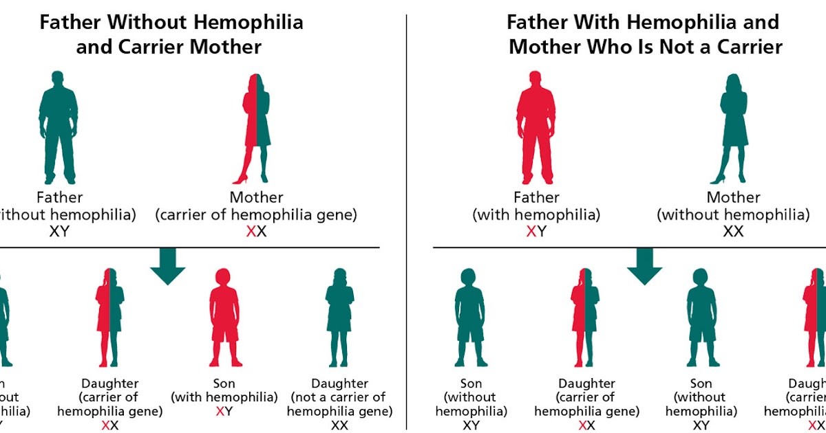 HEMOPHILIA: