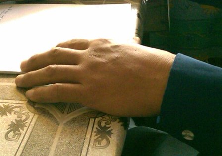 Dalam fikiran si LABU...: Duri Landak dan kegunaannya