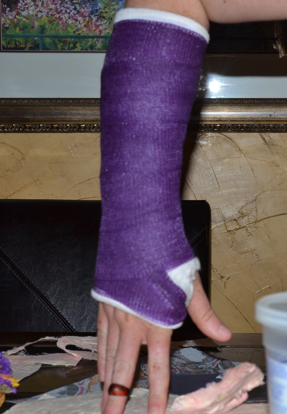 Behind The Blue Door: Fun with broken bones!