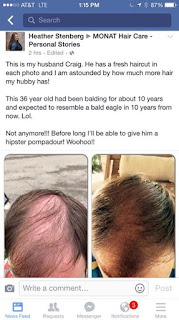 MONAT Global Revolutionary Hair Care Products: Is your hair thinning or ...