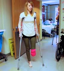 Medical Treatment Pictures-for Better Understanding: Below the knee ...