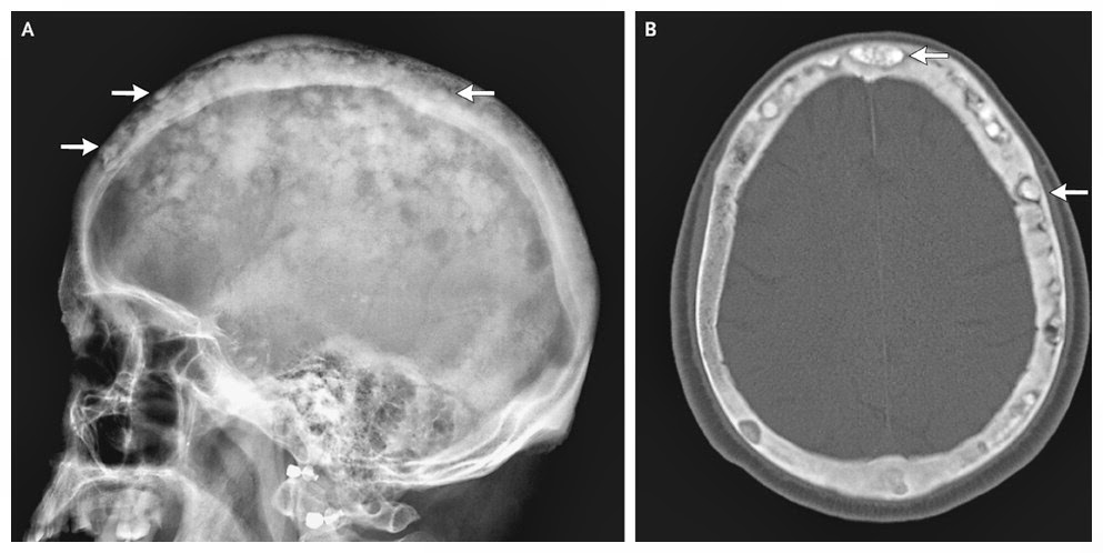 Anatomy and Physiology