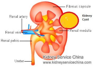 treatment for kidney disease: Cortical Kidney Cysts Can Be Treated