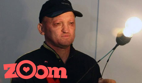 3 Manusia Mutan Di Dunia Nyata - Berita Lucu, Berita Unik, Berita Aneh ...