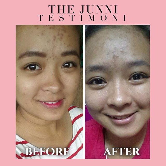 Diary.Nie's Gallery: The Junni Skincare Testimoni / Customer reviews
