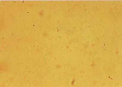 [Haematology] Microscopic Examination of Urinary Sediment ...