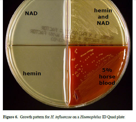 Performing Hemin and NAD Growth Factor Requirement Test Using ...