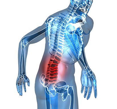Orthopedic Treatment of Back Sprain