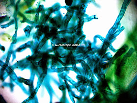 Microscope World Blog: Moss Under the Microscope