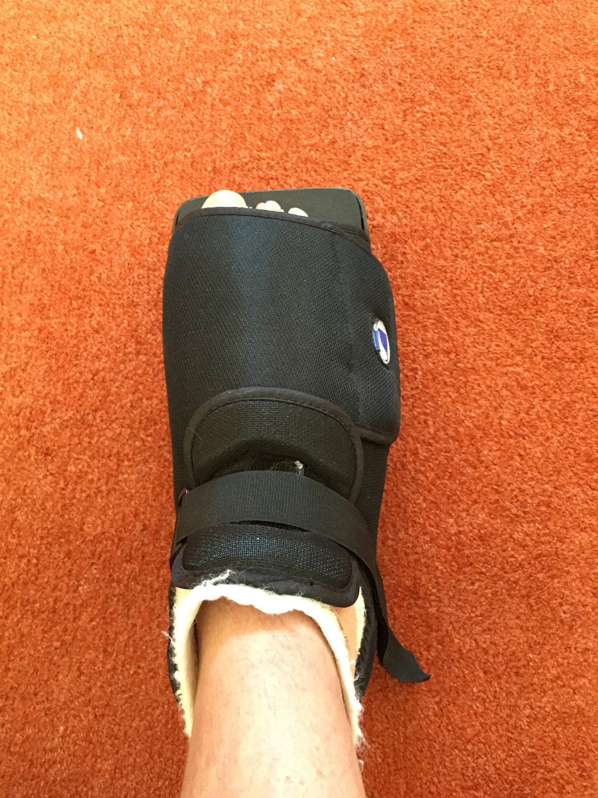 One Boot In Front Of The Other: The Cheilectomy......!!!