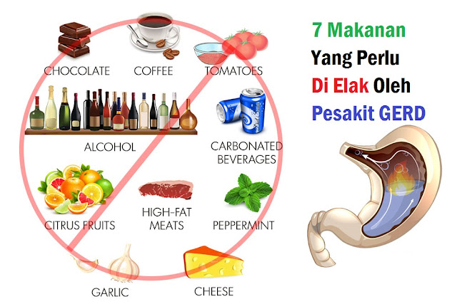 Pesakit Gerd Perlu Elakan 7 Makanan Ini ~ Cara Hidup Sihat