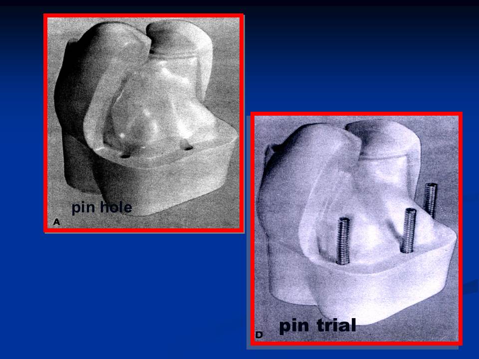 Dentistry: Restoration of badly broken teeth