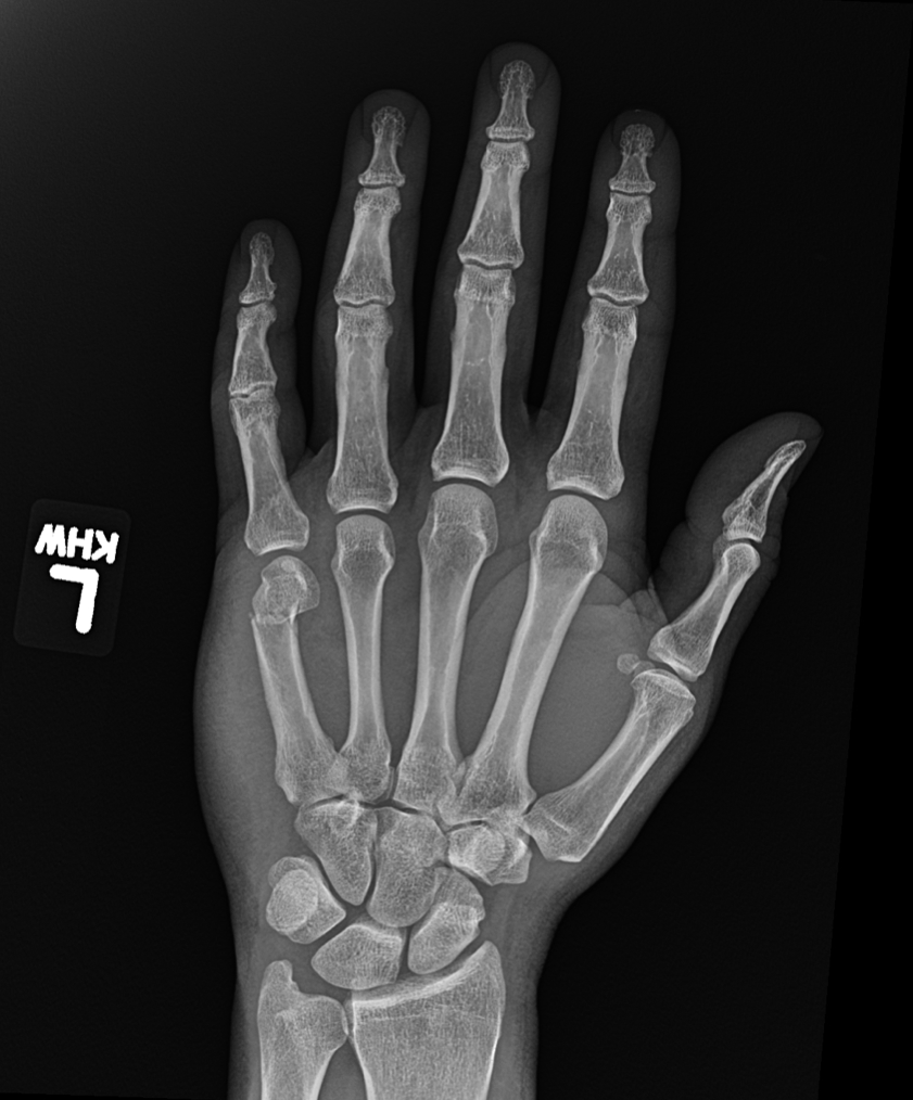 LSUHSC Shreveport Radiology Interest Group