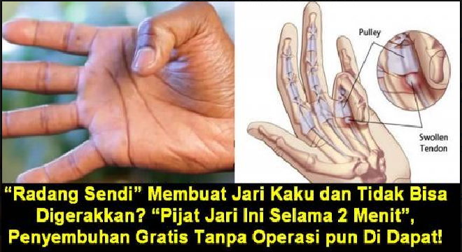 Kenapa Jari Tangan Sakit - Homecare24