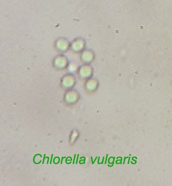 Biology: Scientific Name Of Algea
