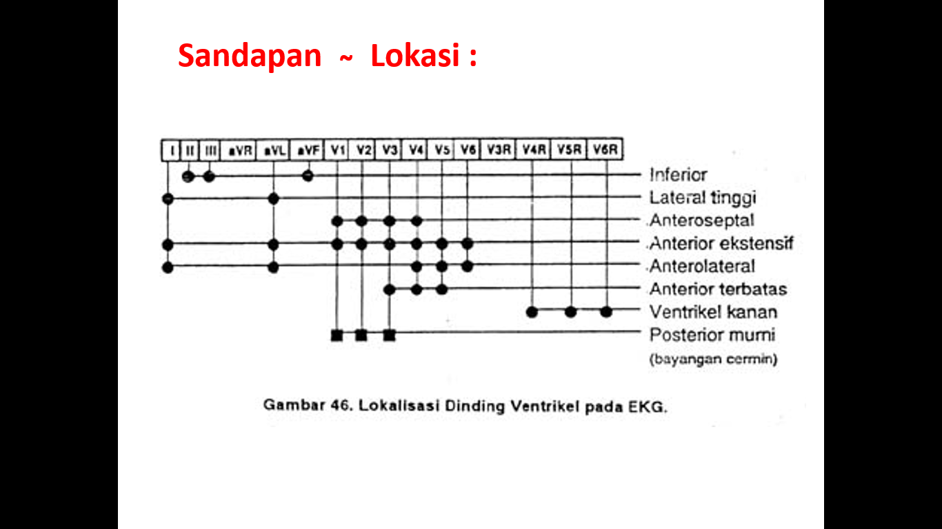 SAYANGI JANTUNG KITA: SADAPAN ECG, EKG