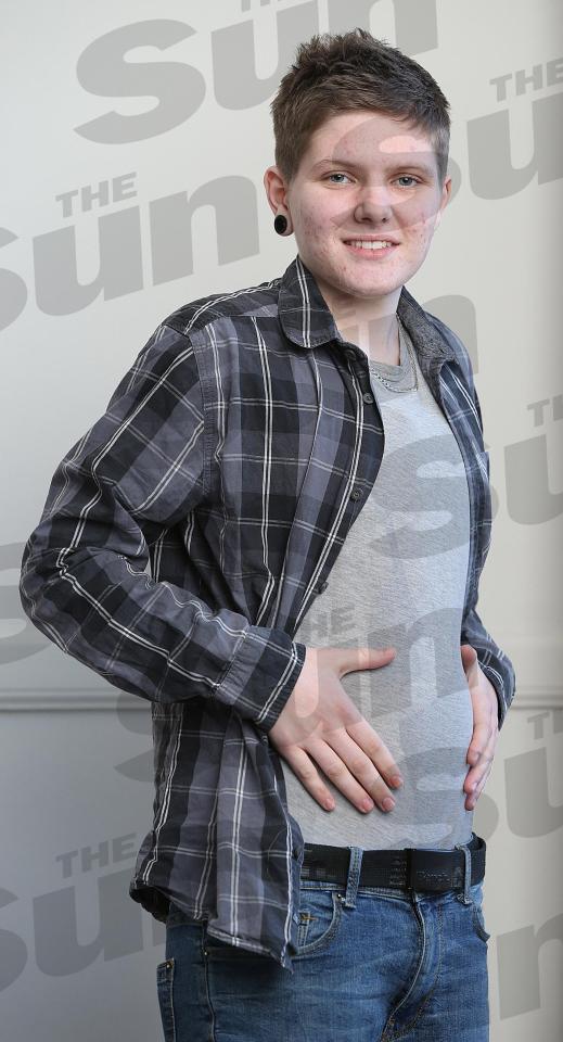 First British Man (transgender) 20 years old will be the first Male ...