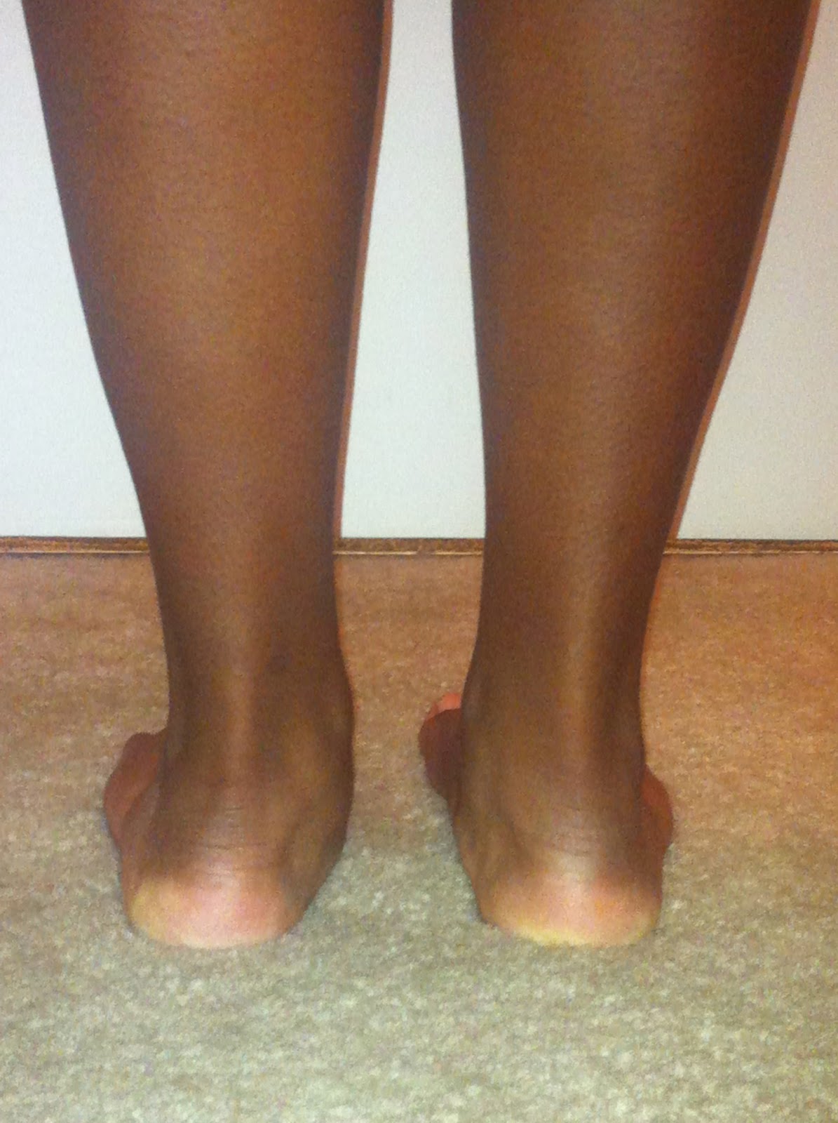 A Runner's Life: REDEFINED: What the heck is PTTD and why do I need ...