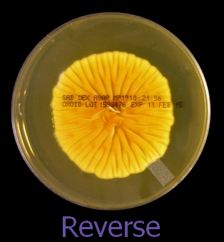 Fun With Microbiology (What's Buggin' You?): Penicillium citrinum