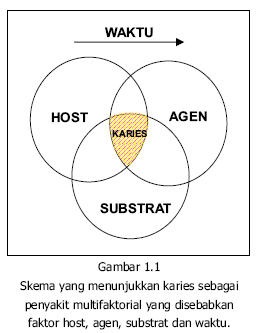 dentistry: pengertian dan etiologi karies
